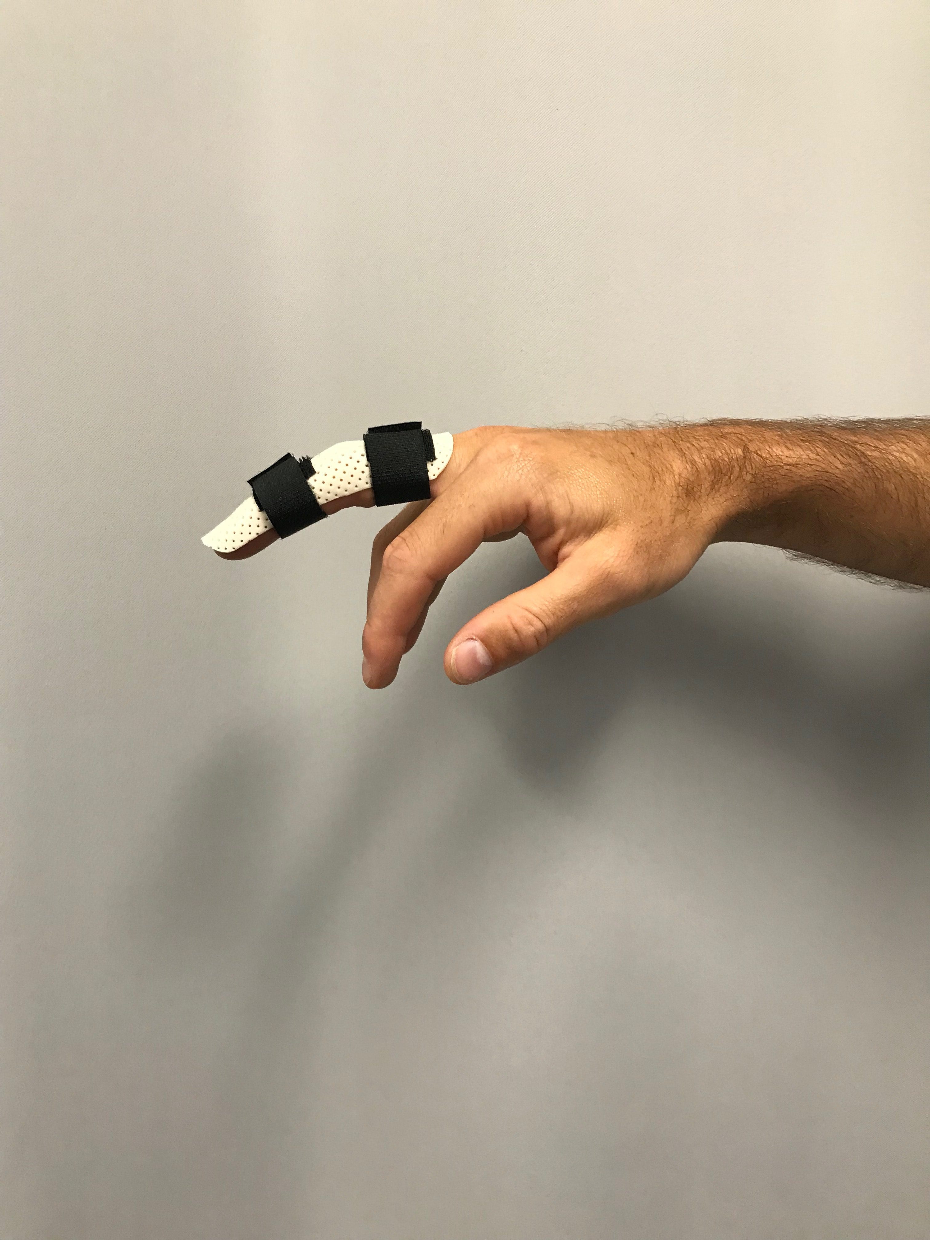 Finger Fractures - Coast Sport